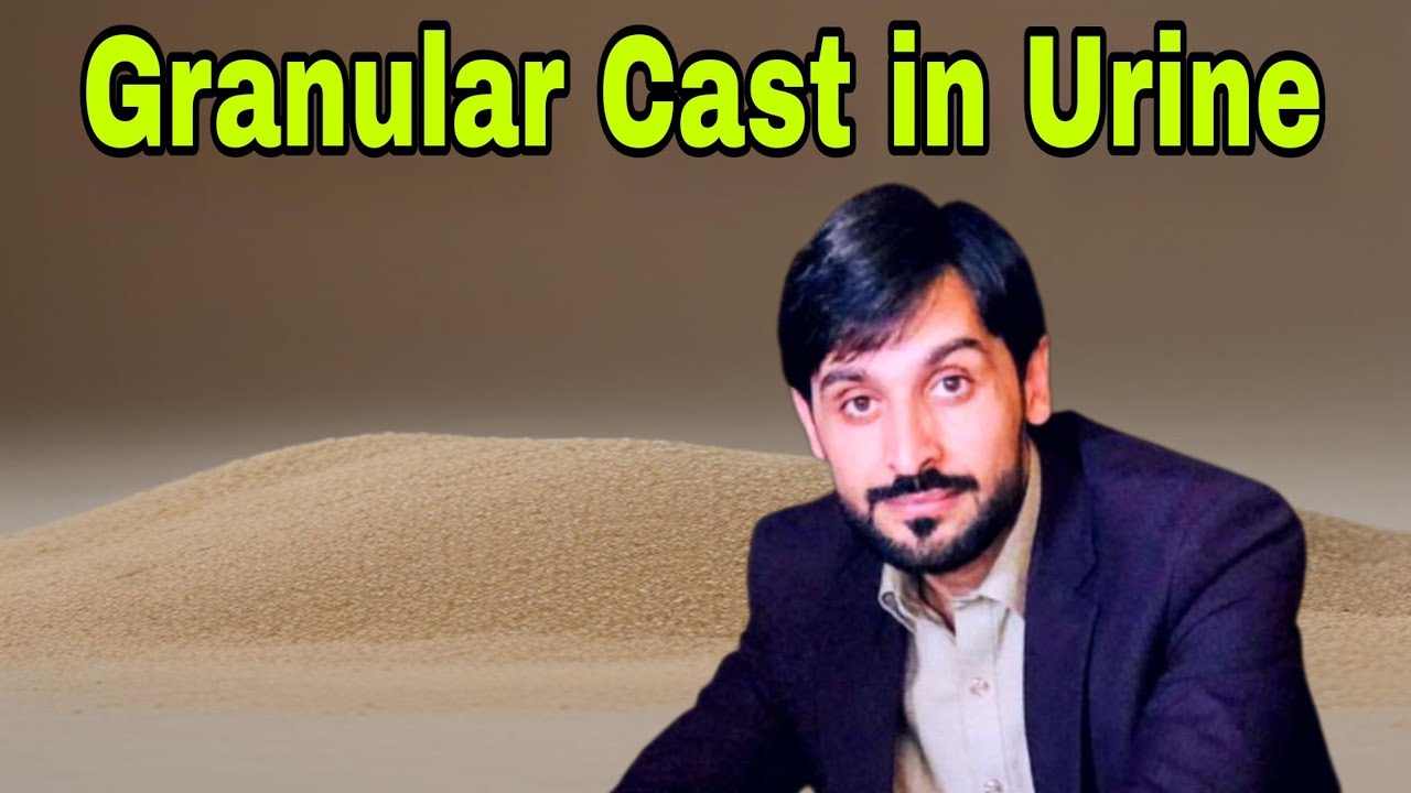 What is Granular Cast | Causes of Granular Cast - YouTube