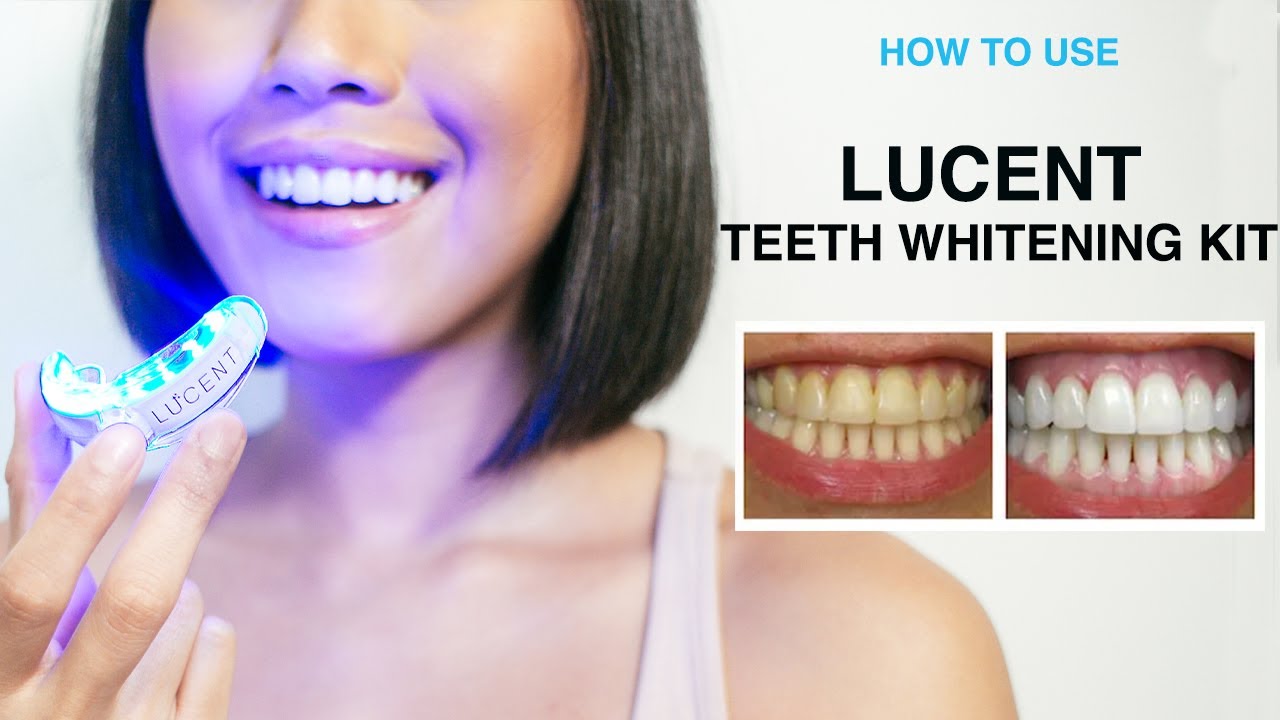 Lucent Teeth Whitening kit (How to use) - YouTube