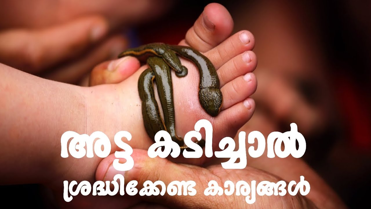 അട്ട കടിച്ചാൽ ശ്രദ്ധിക്കേണ്ട കാര്യങ്ങൾ |HEALTH CARE|MALAYALAM|MEDICINE ...