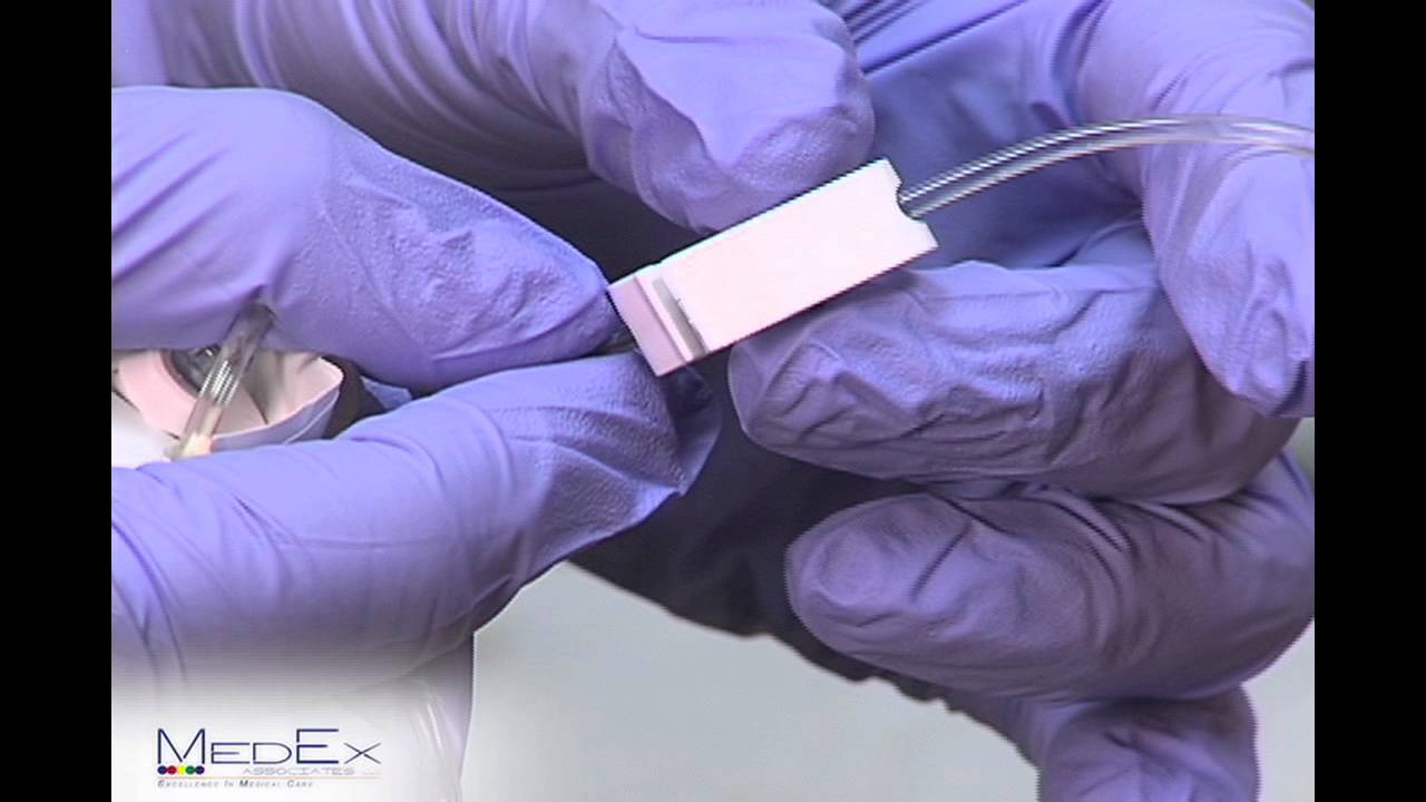 Step 10 Antibiotic Infusion - YouTube