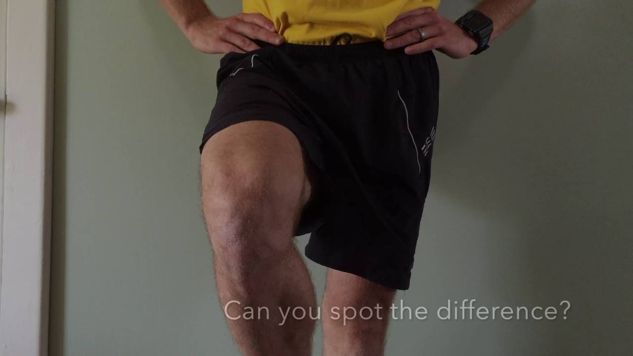 Trendelenburg's Sign - YouTube