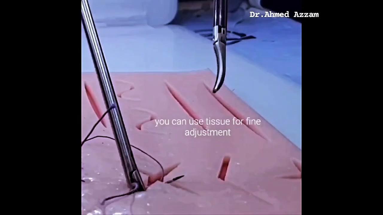 Laparoscopic Suturing Tips Needle Mounting And Adjustment Youtube