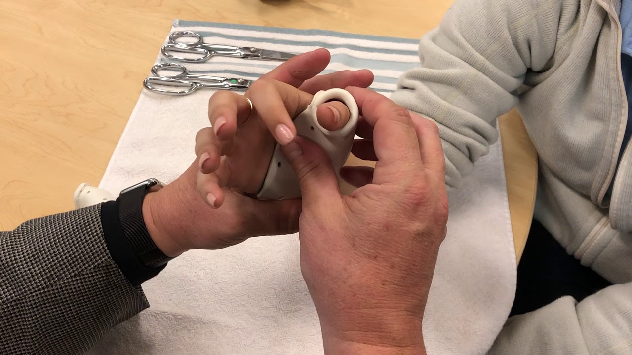OT 740: Hand Based Thumb Spica Splint - Part 3 - YouTube