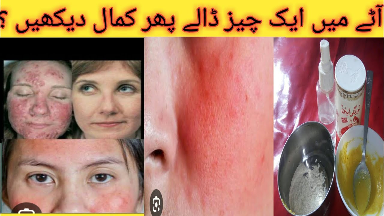 Bleach sy jali skin k liy tips | jali skin k liye face pack | - YouTube