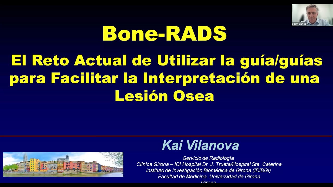 731 - Bone-RADS: interpretación de una lesión ósea - YouTube