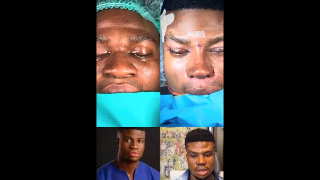 Isaac Aloma Plastic Surgery – Zicsloma Transformation & Insights - YouTube