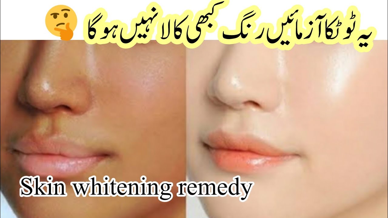 Beauty tips for Sun burn Skin | Sunburn causes and treatment - YouTube