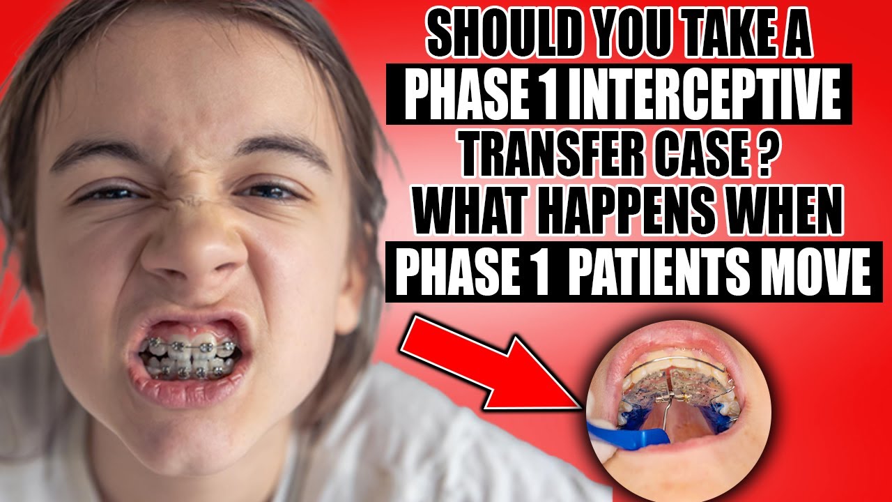 Taking a Phase 1 Interceptive Transfer Case- Moving after Starting RPE ...