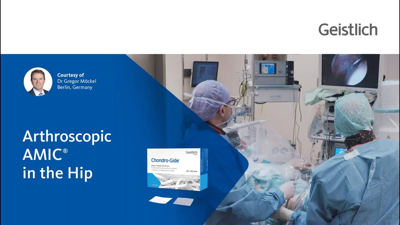 Arthroscopic AMIC® Hip Surgery, Dr Gregor Möckel (Berlin, GER) - YouTube