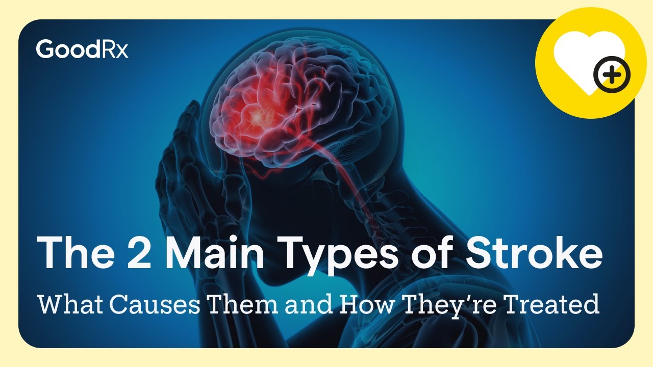 Understanding the 2 Main Types of Stroke: What Causes Them and How They ...