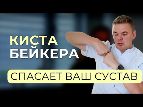 Киста Бейкера: лечить или удалять? Узнайте, как сохранить суставы здоровыми!