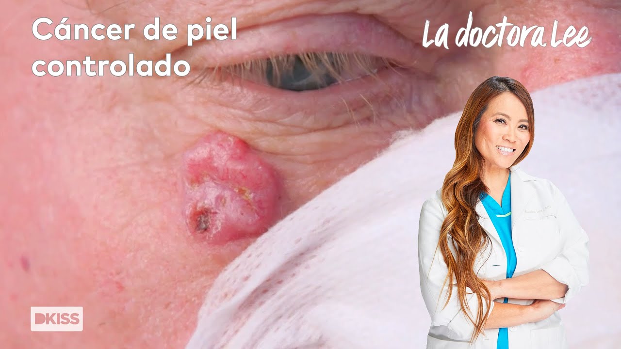 Un bulto cancerígeno en su segunda visita | La doctora Lee - YouTube