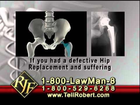 Hip Replacement Recall Lawsuit Lawyer, Stryker Hip Replacement Lawyer ...