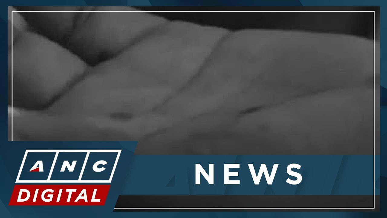 Dr. Solante: Mpox transmitted through 'close, prolonged' skin-to-skin contact | ANC - YouTube