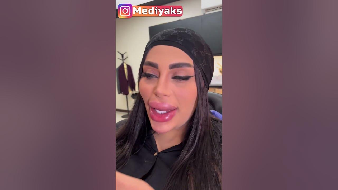 شبیه کون مرغ شده 🐔 Youtube