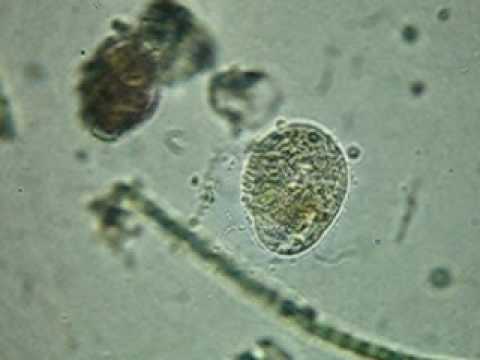 Step 1: Spirotrich ciliate starts hatching out of cyst - YouTube