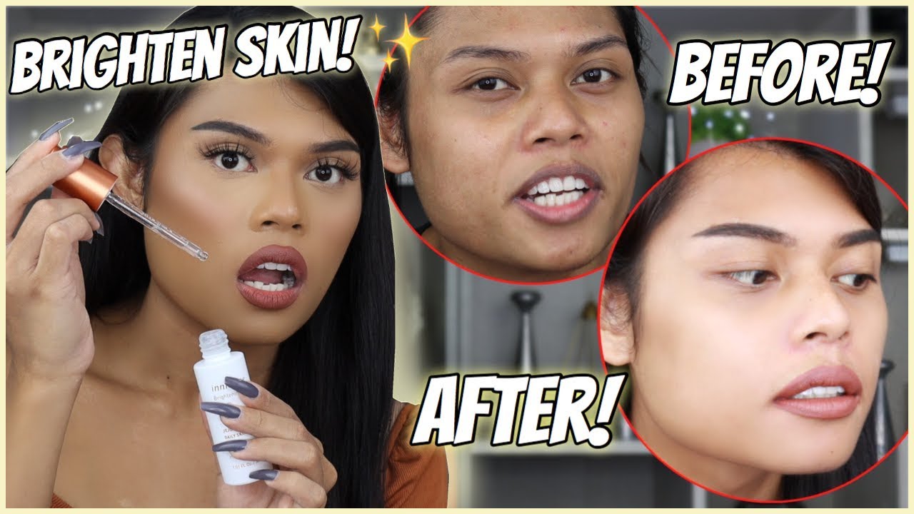 ERASE STUBBORN DARK SPOTS AND BRIGHTEN SKIN WITH THIS SERUM!!! SOBRANG ...