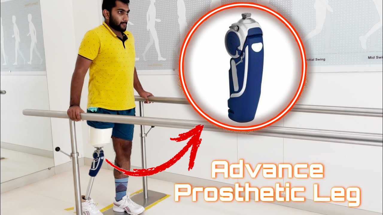 My 1st Prosthetic Leg || Ottobock || 3r80 knee joint || Advance ...