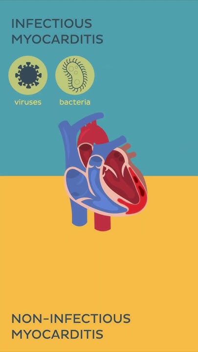 Myocarditis Causes Kenhub Shorts Youtube