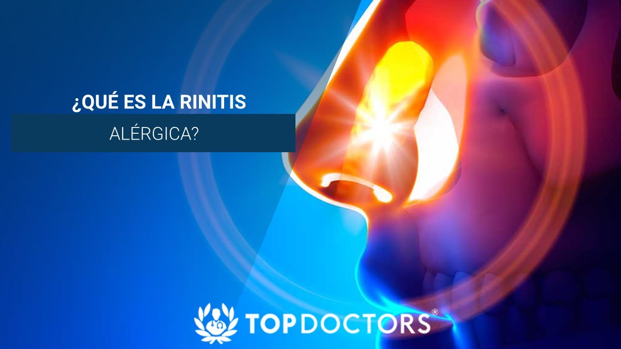 ¿Qué es la Rinitis Alérgica? - YouTube