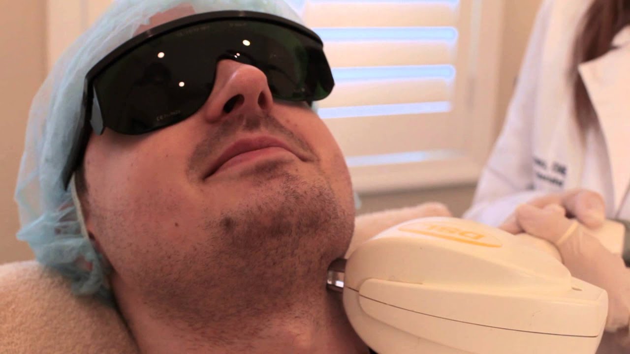 Laser Permanent Hair Removal at JVAI - YouTube