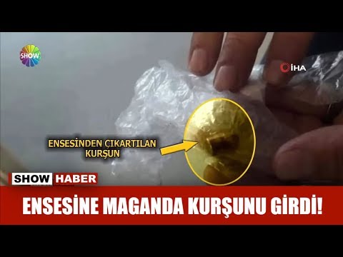 Ensesine maganda kurşunu girdi!