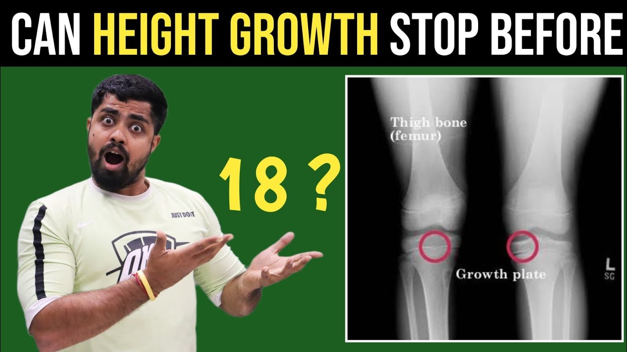 Can HEIGHT GROWTH Stop Before 18 - Real Video Proof ? - YouTube