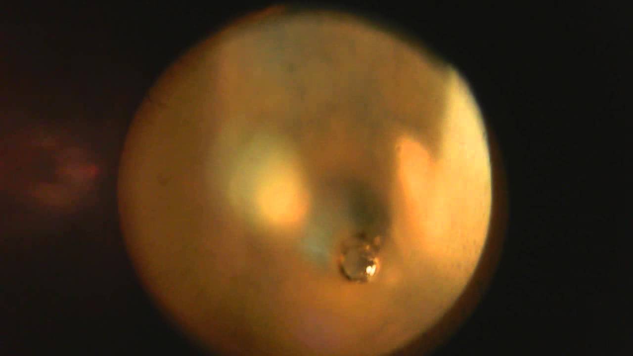 Microscope Video #4 - Checking Record Player Needles - YouTube