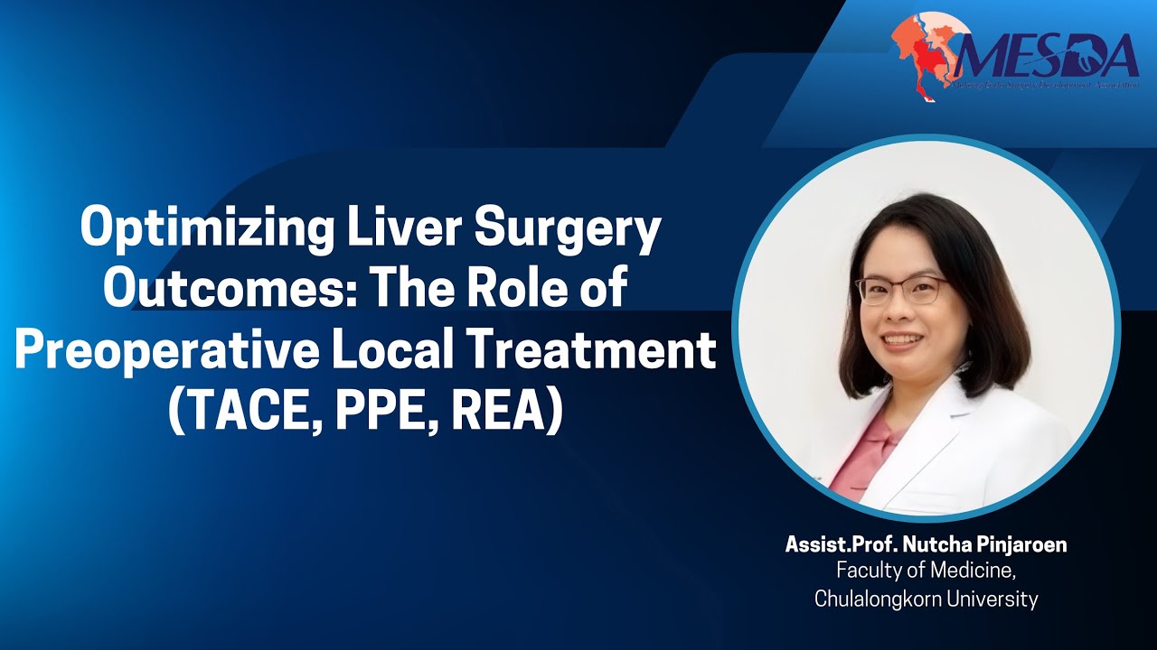 Optimizing Liver Surgery Outcomes: The Role of Preoperative Local ...