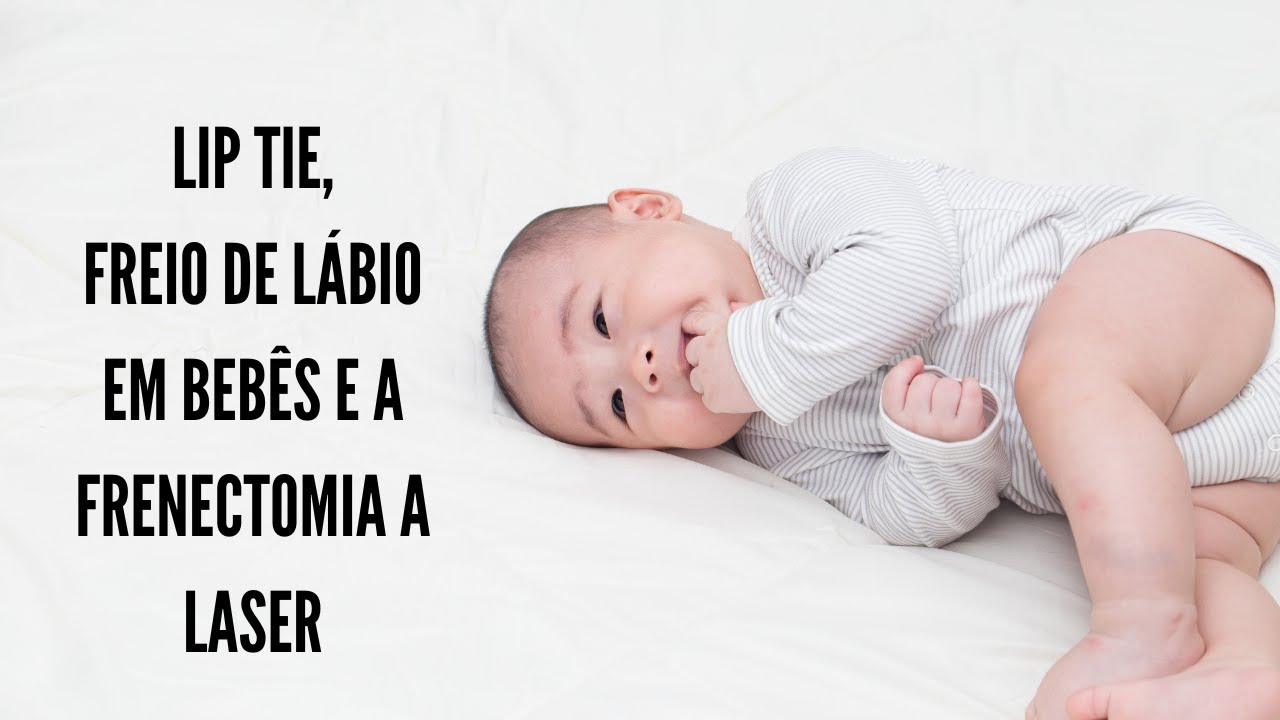 Lip tie, freio de lábio em bebês e frenectomia a laser - YouTube