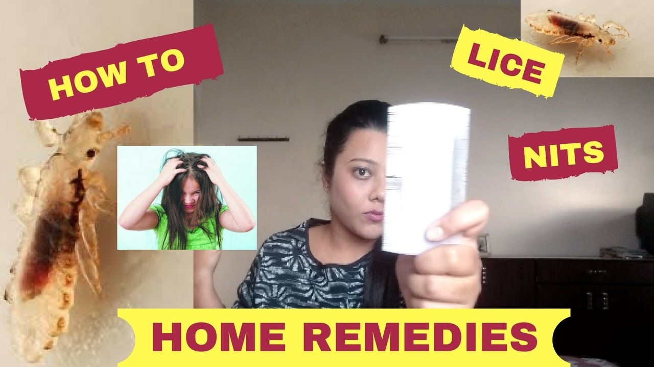How to get RID of LICE #HEAD LICE #LICE EGGS and or NITS ( home ...