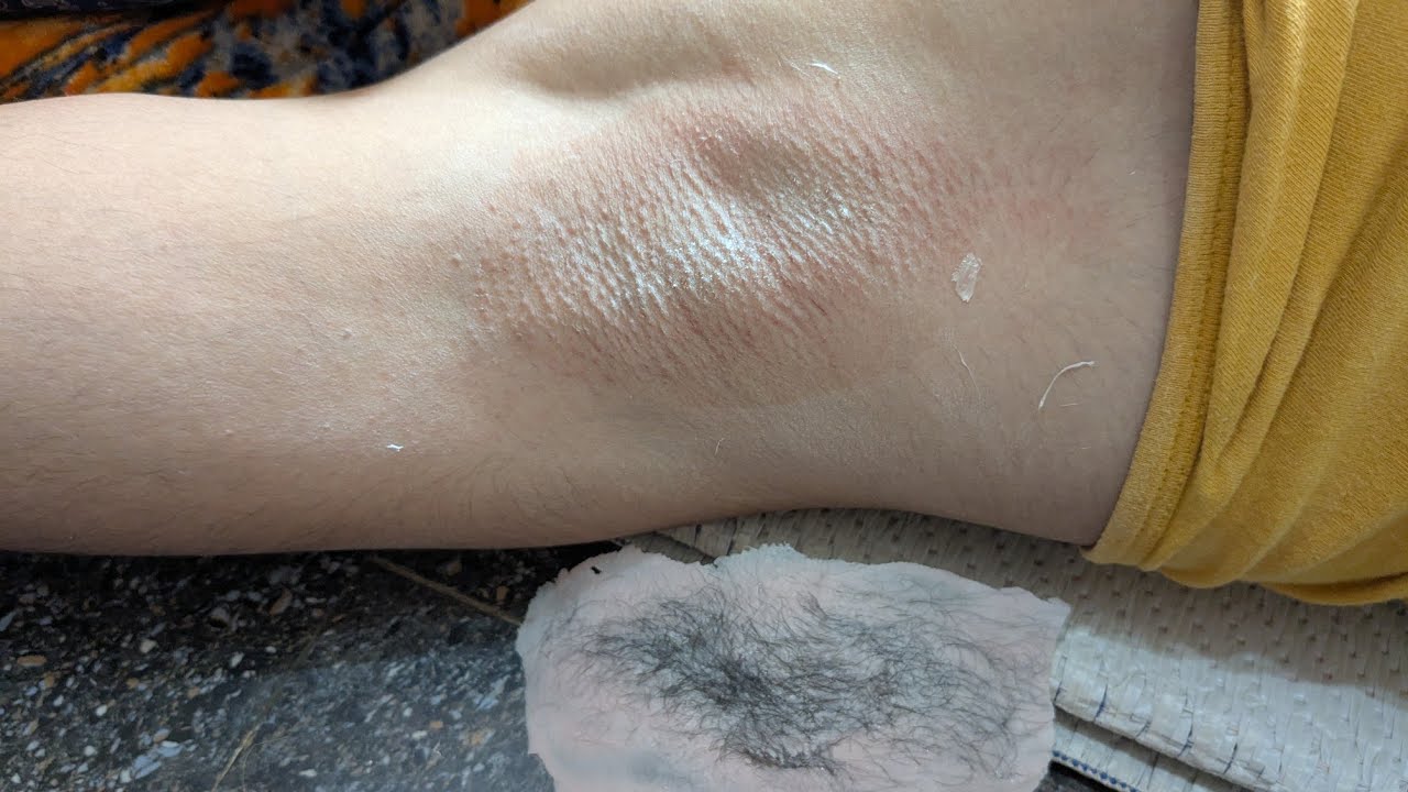 Under arm waxing// clean and clear skin// skin care 💅 - YouTube