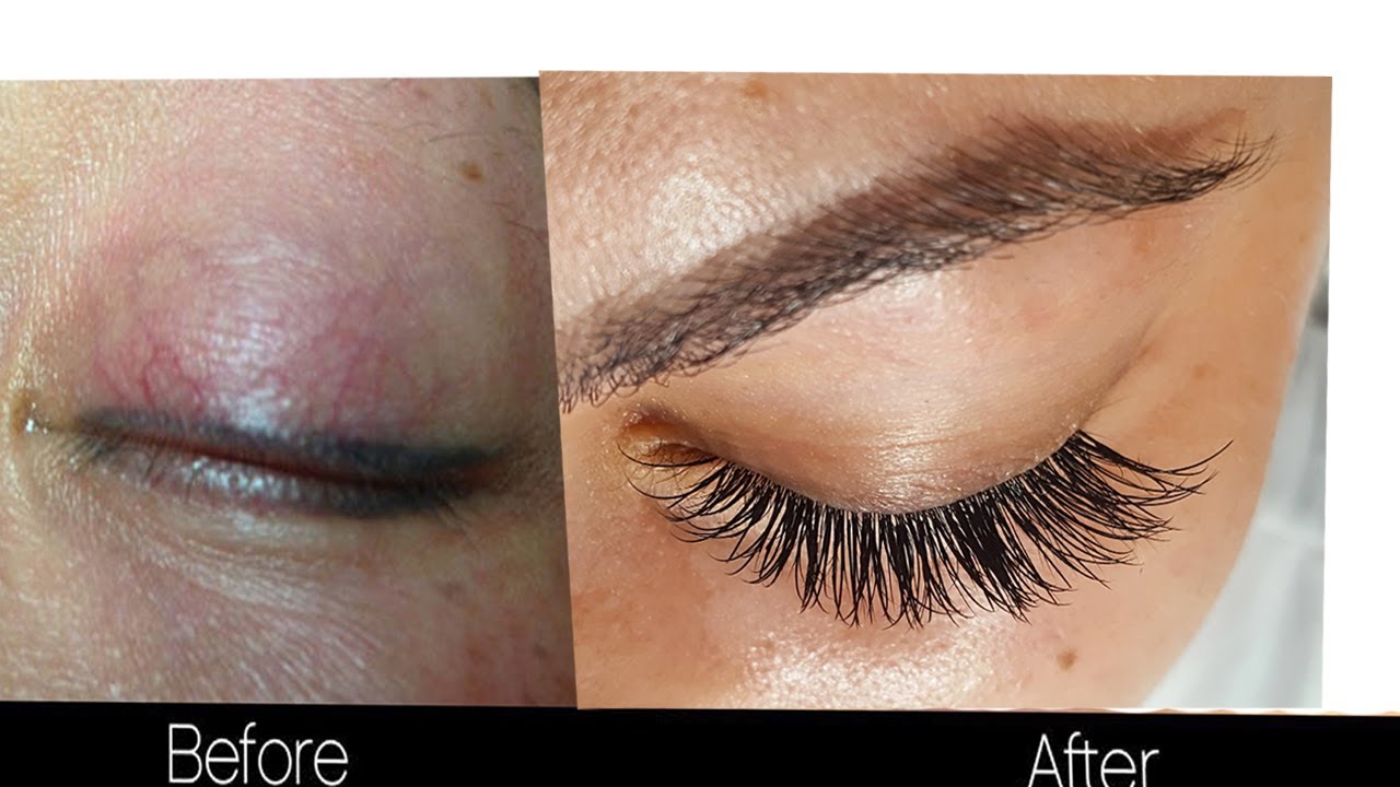 😢😢Why Are My Eyelashes Falling Out? ( How I Regrow My Alopecia Eyes ...
