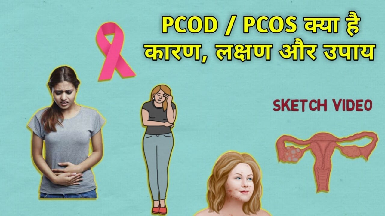 PCOD/PCOS होने के लक्षण, कारण और उपचार | PCOD Causes, Symptoms ...