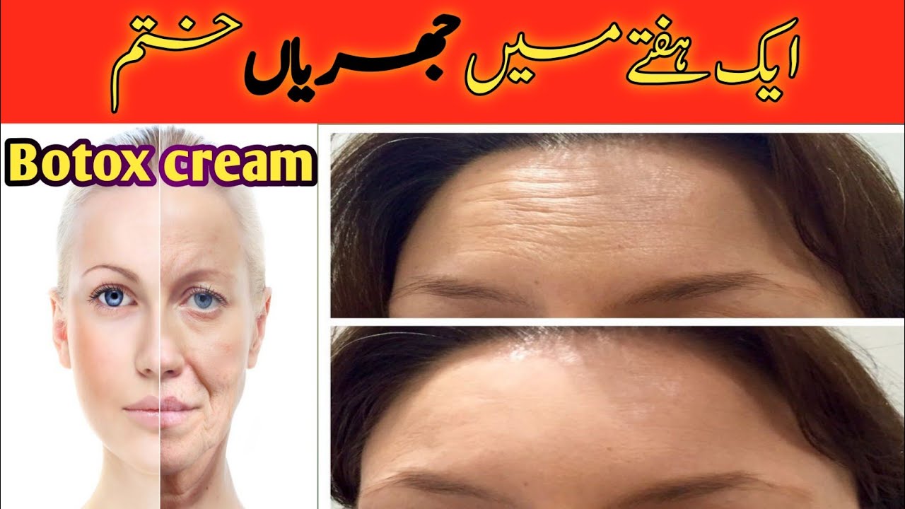 Get Rid of wrinkles just 7 days||powerfull Botox cream||Jhuriya khatm ...