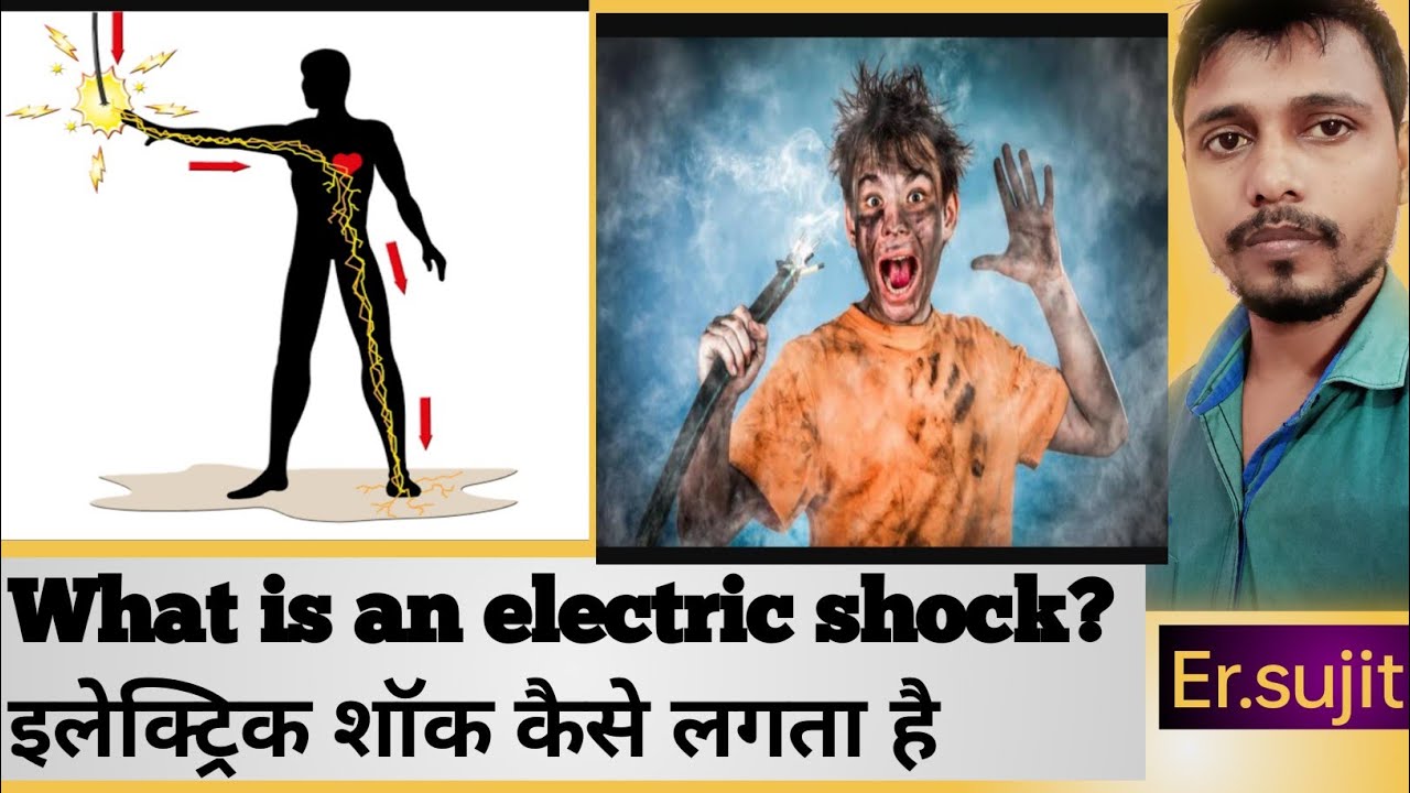 Electric Shock | What is an electric shock - YouTube