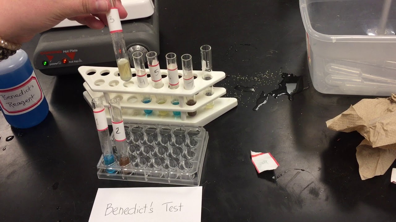 Benedict'sTest, part 2 - YouTube