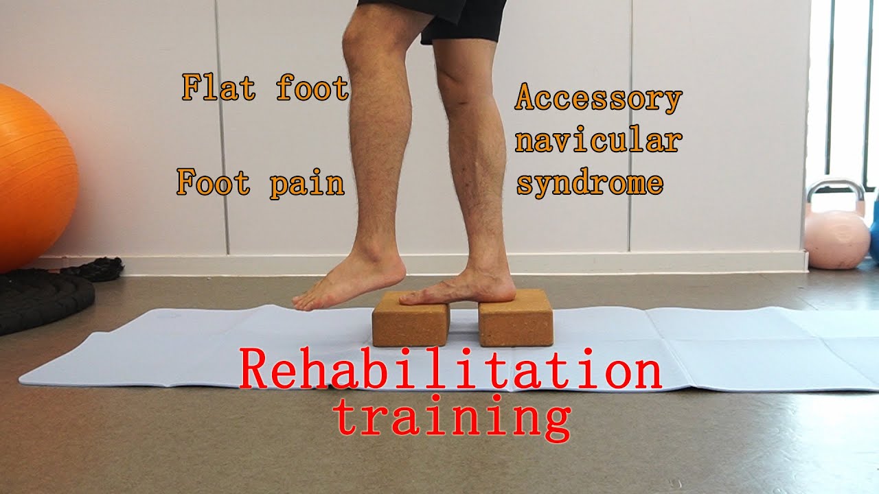 Rrehabilitation training to cure the accessory navicular syndrome ...