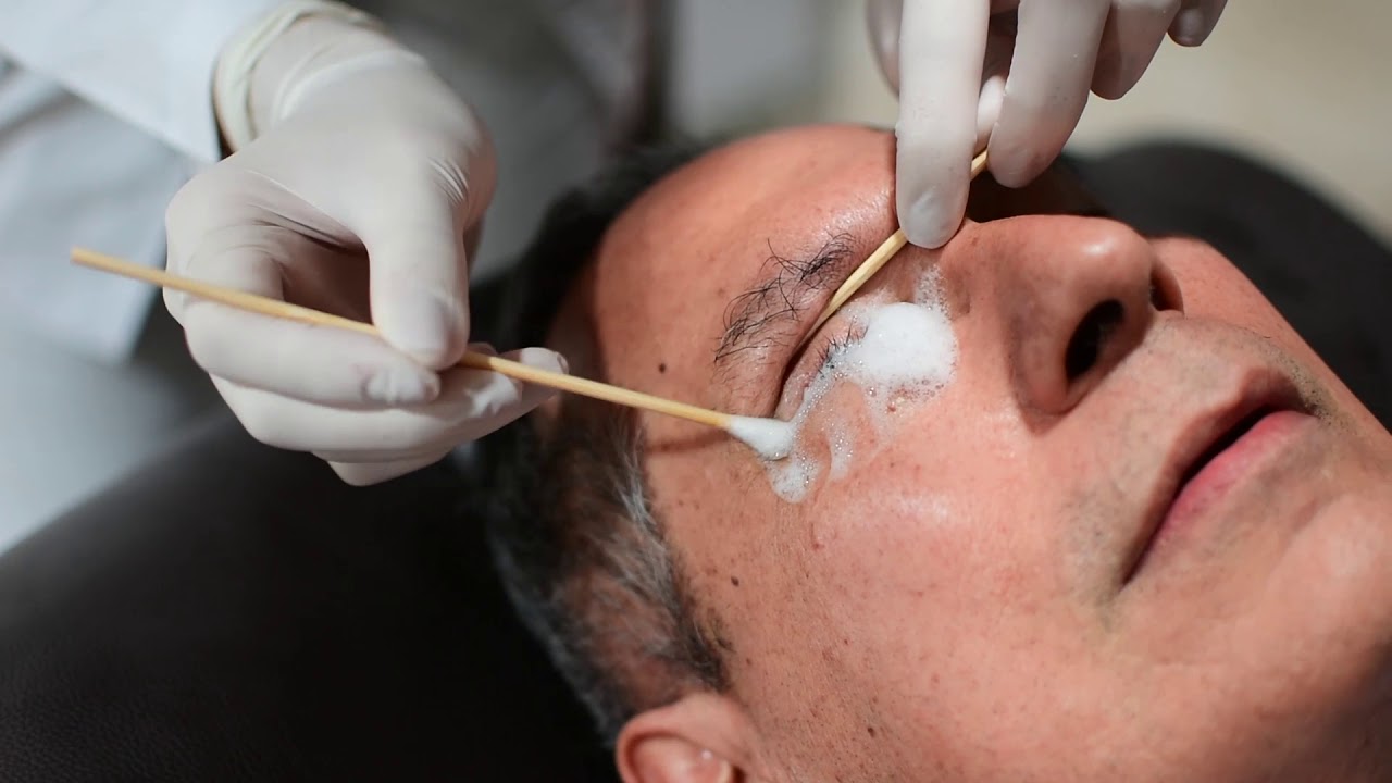 Tratamiento para el Demodex - YouTube