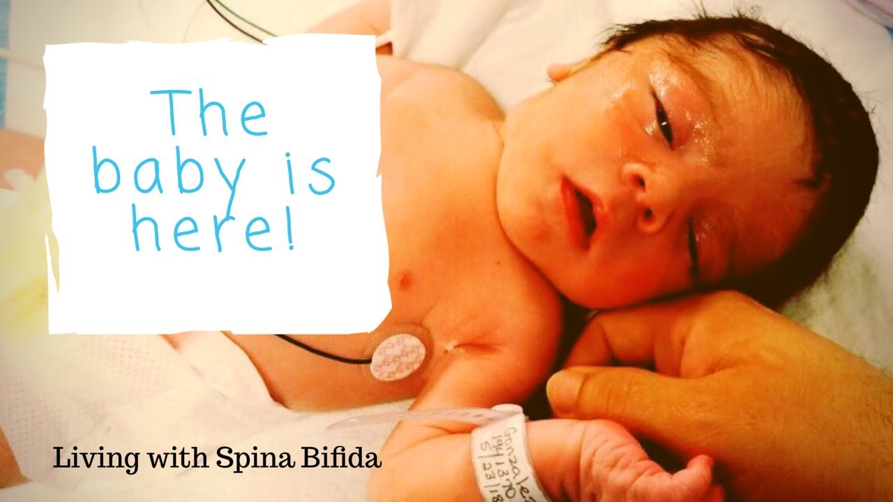 One Week Baby Update: living with Spina Bifida - YouTube