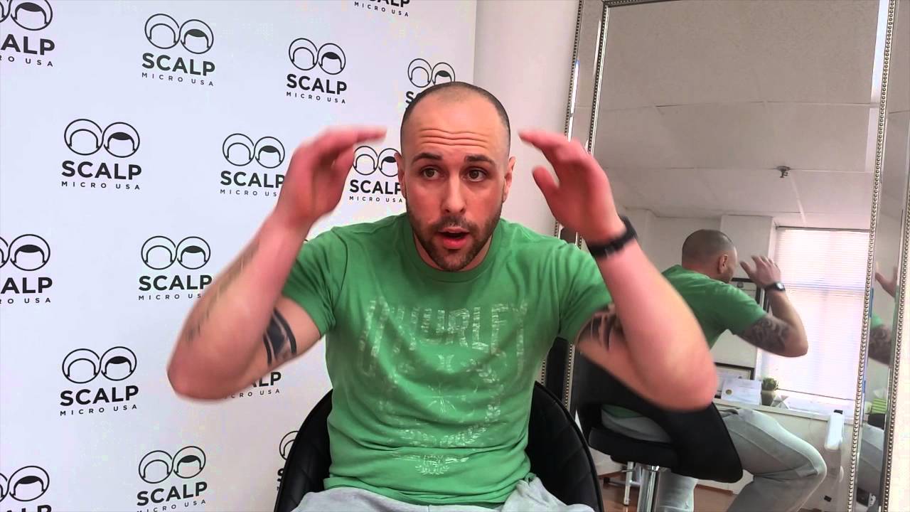 Scalp Micropigmentation by Matt Iulo- Steve's Testimonial - Scalp Micro ...