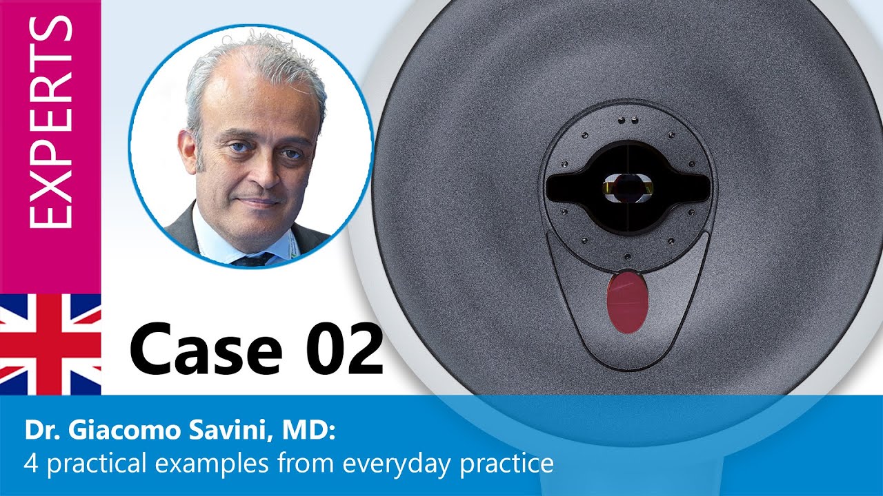 Dr. Giacomo Savini, MD: case 2 of 4 from everyday practice: Post-LASIK ...