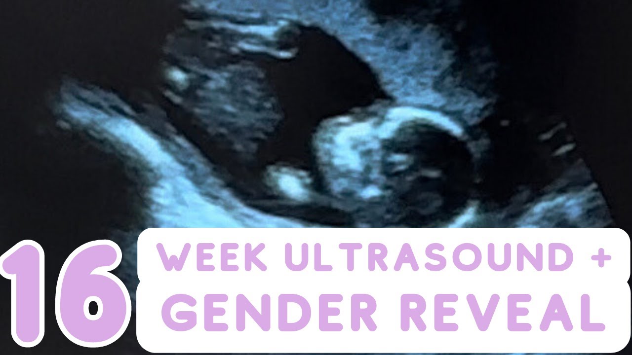 16 Week Ultrasound | Gender Reveal | FET #2 | Embryo Adoption | Embryo ...