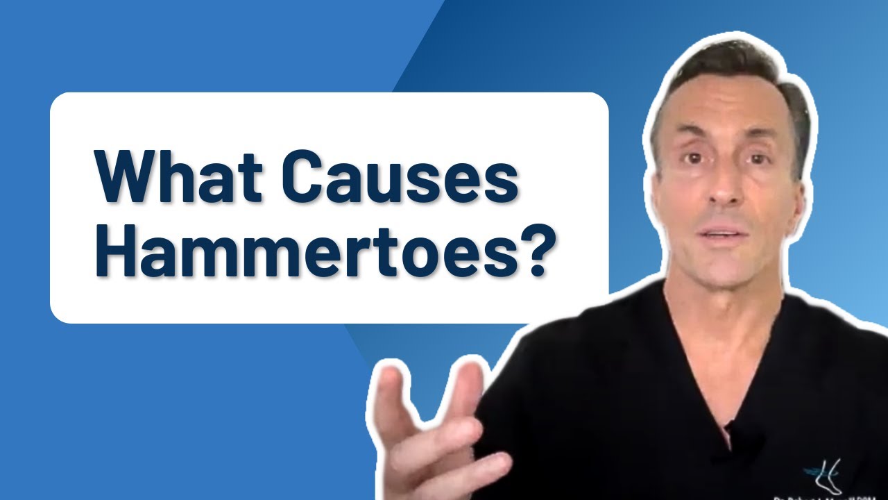 What Is The Main Cause of Hammertoes? - YouTube