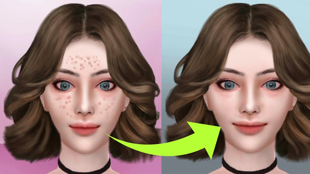 ASMR Acne Treatment animation video|| acne removal satisfied🌝🌚#makeup # ...