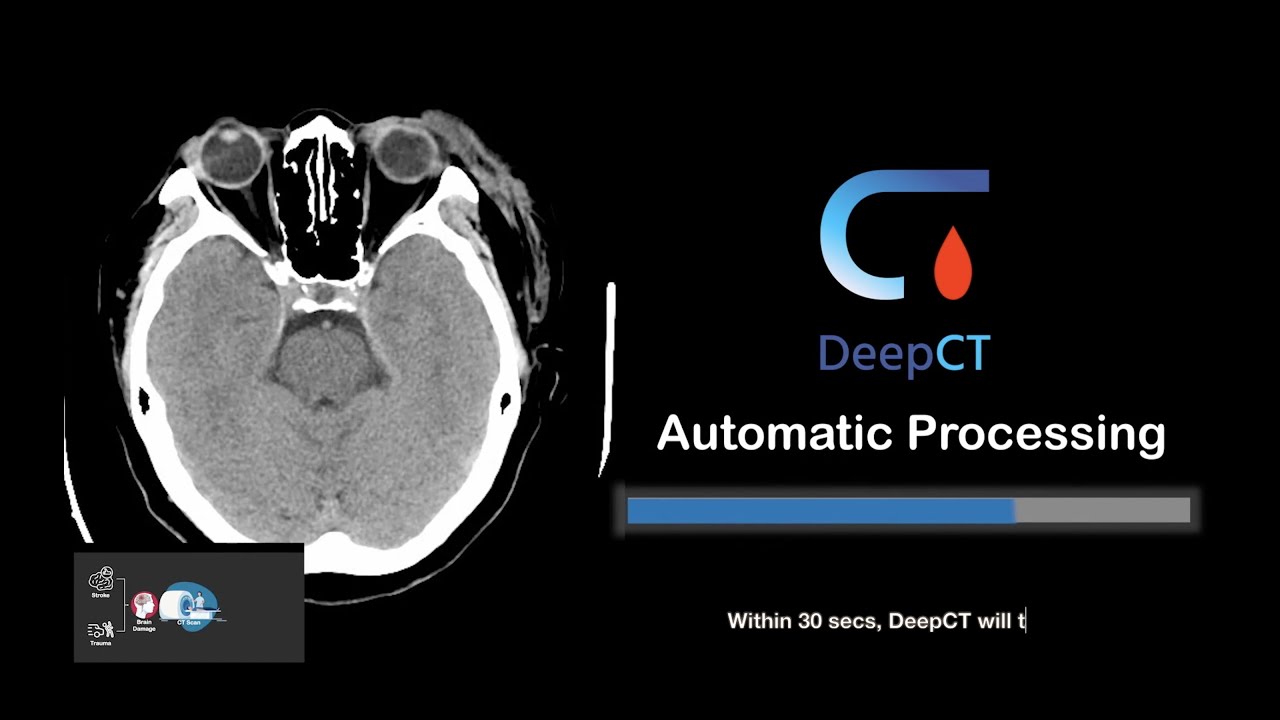 DeepCT - Brain CT AI Software for ICH Identification, Localization, and ...
