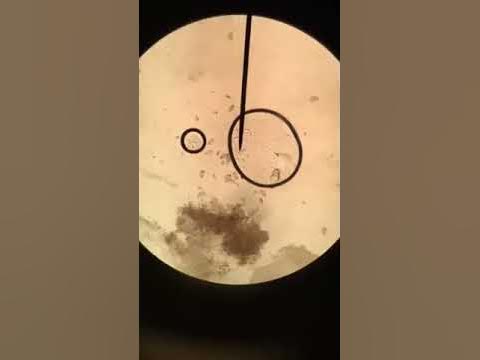 Protists from hay infusion - YouTube