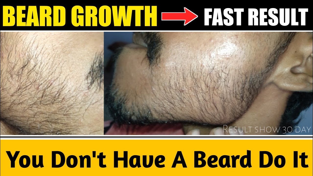 BEARD GROWTH | FAST RESULT | You don't have a beard do it | How to grow ...