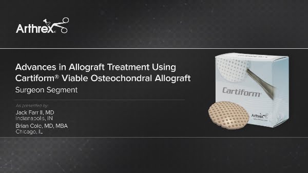 Advances in Allograft Treatment Using Cartiform® Viable Osteochondral ...