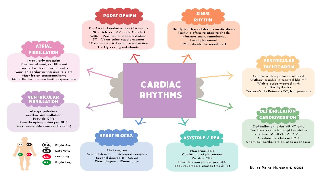 Cardiac rhythm / ECG treatment (Medsurg/Adult health) ADN/BSN concept ...